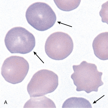 Rodak's Hematology Clinical Principles and Applications