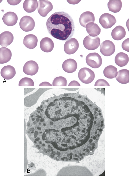 Rodak's Hematology Clinical Principles and Applications