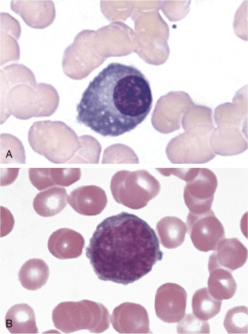Rodak's Hematology Clinical Principles and Applications