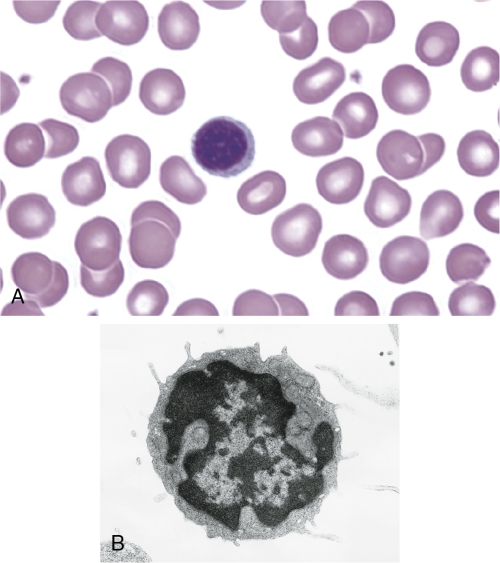 Rodak's Hematology Clinical Principles and Applications