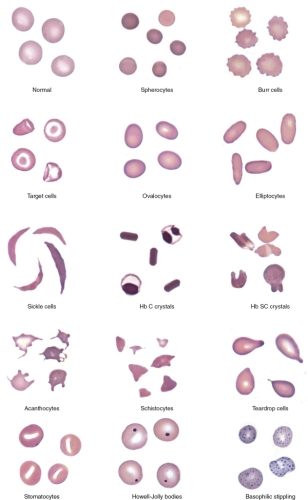 Rodak's Hematology Clinical Principles and Applications