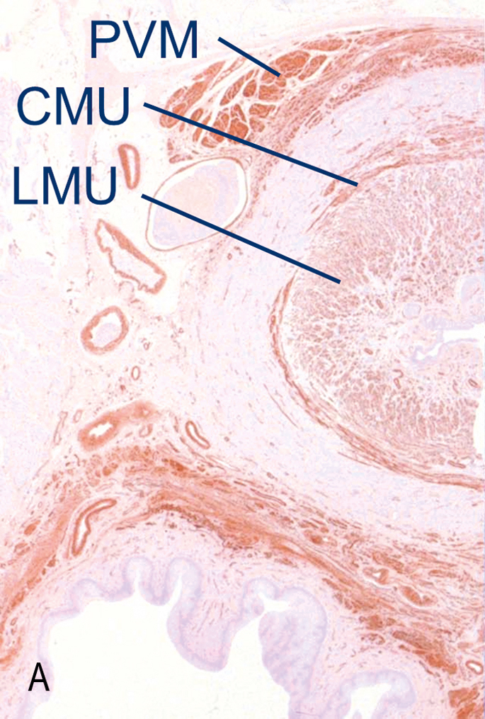 Functional Anatomy of the Female Pelvic Floor
