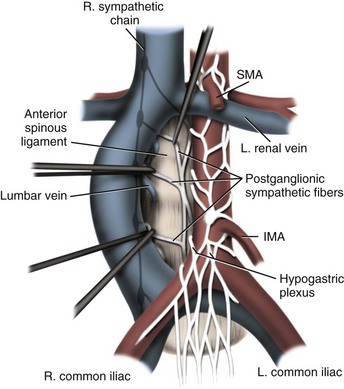 Campbell-Walsh Urology