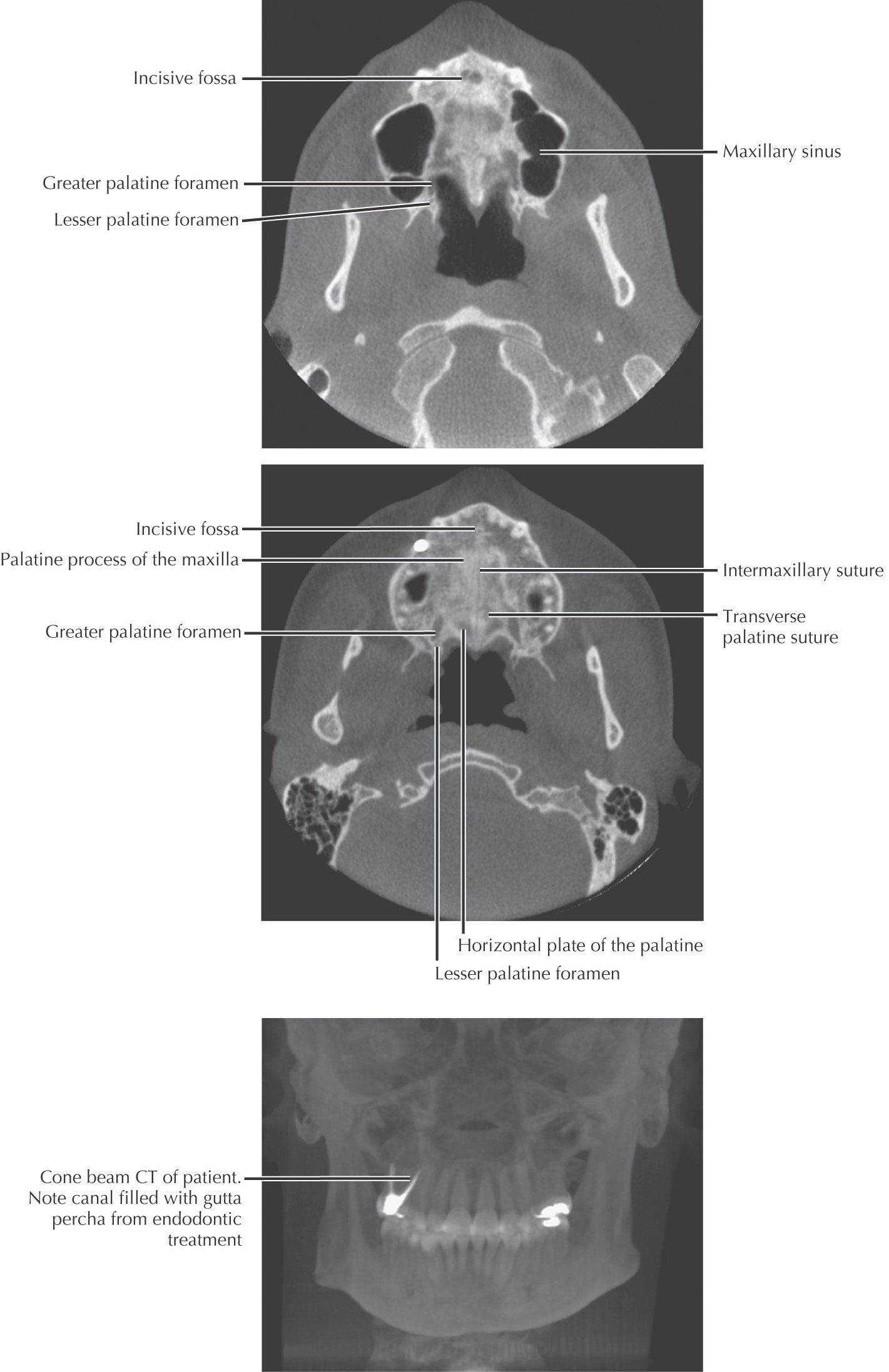 Netter’s Head and Neck Anatomy for Dentistry