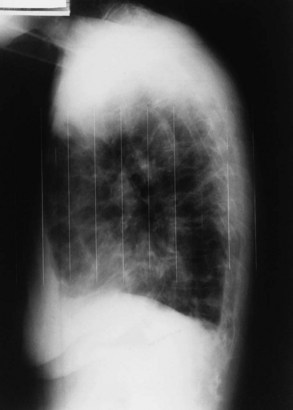 Radiologic Science for Technologists: Physics, Biology, and Protection