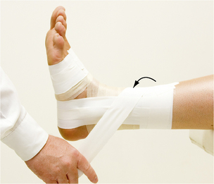 An Illustrated Guide to Taping Techniques: Principles and Practice