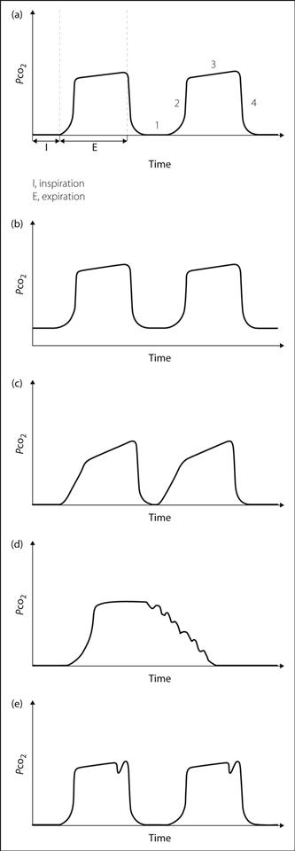 Anaesthesia and Intensive Care A-Z