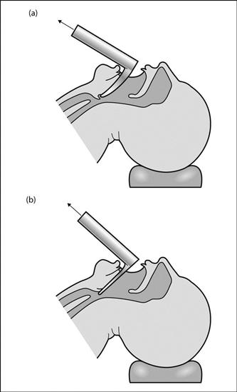 Anaesthesia and Intensive Care A-Z