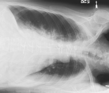Bontrager’s HANDBOOK OF RADIOGRAPHIC POSITIONING AND TECHNIQUES