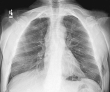 Bontrager’s HANDBOOK OF RADIOGRAPHIC POSITIONING AND TECHNIQUES