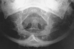 Bontrager’s HANDBOOK OF RADIOGRAPHIC POSITIONING AND TECHNIQUES