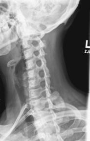 Bontrager’s HANDBOOK OF RADIOGRAPHIC POSITIONING AND TECHNIQUES