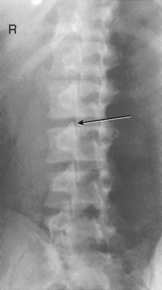 Bontrager’s HANDBOOK OF RADIOGRAPHIC POSITIONING AND TECHNIQUES