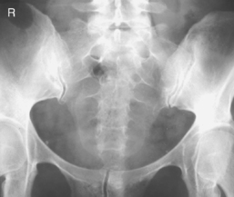 Bontrager’s HANDBOOK OF RADIOGRAPHIC POSITIONING AND TECHNIQUES