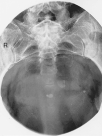 Bontrager’s HANDBOOK OF RADIOGRAPHIC POSITIONING AND TECHNIQUES