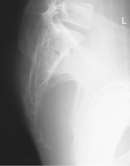 Bontrager’s HANDBOOK OF RADIOGRAPHIC POSITIONING AND TECHNIQUES