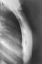 Bontrager’s HANDBOOK OF RADIOGRAPHIC POSITIONING AND TECHNIQUES