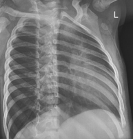 Bontrager’s HANDBOOK OF RADIOGRAPHIC POSITIONING AND TECHNIQUES