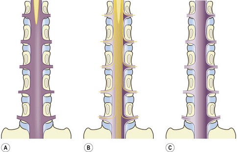 Clinical and Radiological Anatomy of the Lumbar Spine