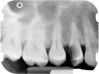 Dental Radiography: Principles and Techniques
