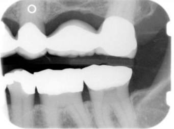 Dental Radiography: Principles and Techniques