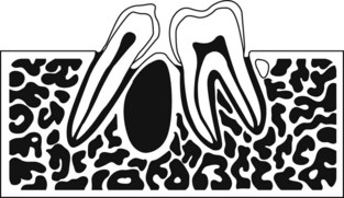 Dental Radiography: Principles and Techniques