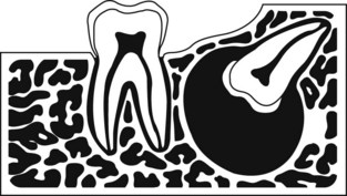 Dental Radiography: Principles and Techniques