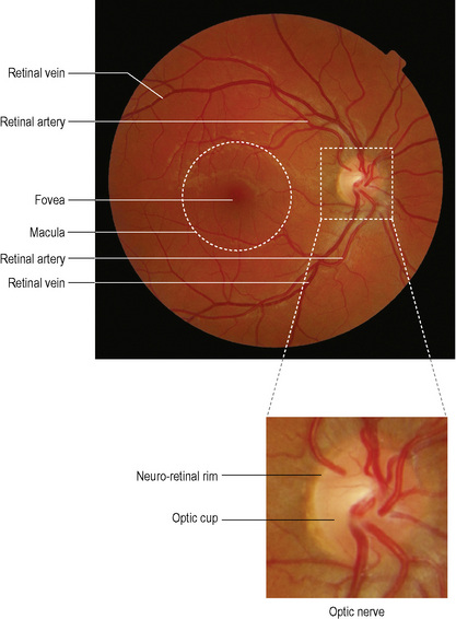 Fundoscopy Made Easy
