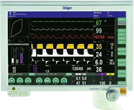 Essentials of Anaesthetic Equipment