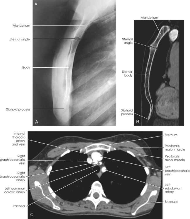 MERRILL’S ATLAS of RADIOGRAPHIC POSITIONING & PROCEDURES