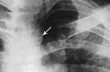 MERRILL’S ATLAS of RADIOGRAPHIC POSITIONING & PROCEDURES