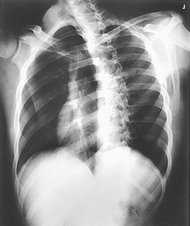 MERRILL’S ATLAS of RADIOGRAPHIC POSITIONING & PROCEDURES