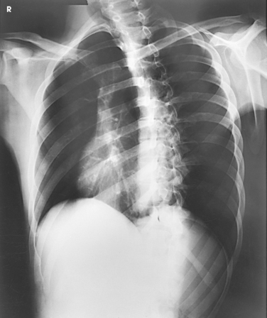 MERRILL’S ATLAS of RADIOGRAPHIC POSITIONING & PROCEDURES