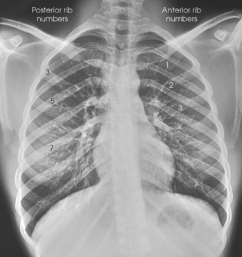 MERRILL’S ATLAS of RADIOGRAPHIC POSITIONING & PROCEDURES