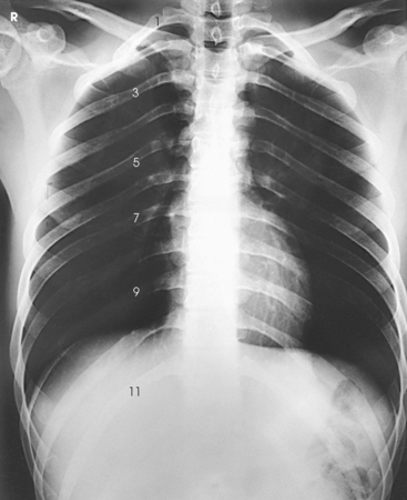 MERRILL’S ATLAS of RADIOGRAPHIC POSITIONING & PROCEDURES