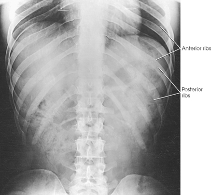 MERRILL’S ATLAS of RADIOGRAPHIC POSITIONING & PROCEDURES