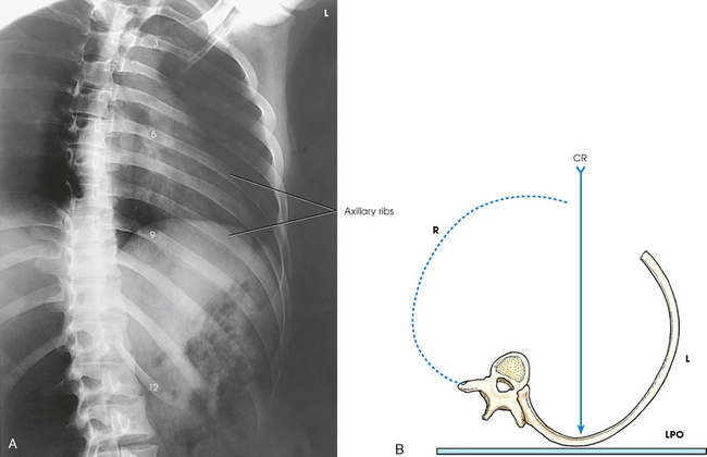MERRILL’S ATLAS of RADIOGRAPHIC POSITIONING & PROCEDURES