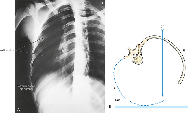MERRILL’S ATLAS of RADIOGRAPHIC POSITIONING & PROCEDURES