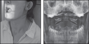 Pocketbook of Radiographic Positioning