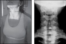 Pocketbook of Radiographic Positioning