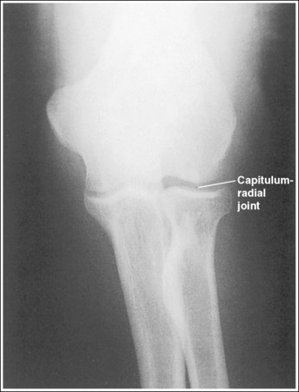 Radiographic Image Analysis