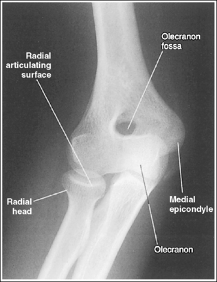 Radiographic Image Analysis