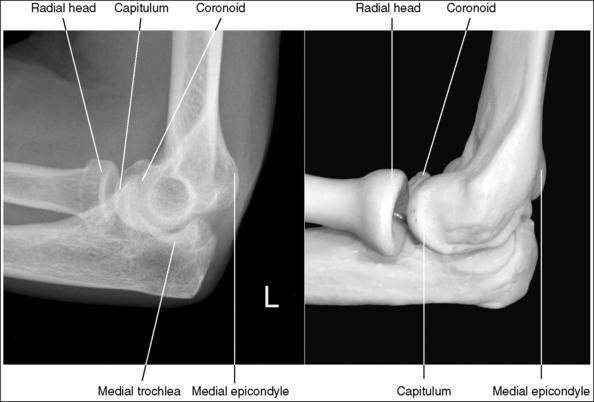 Radiographic Image Analysis