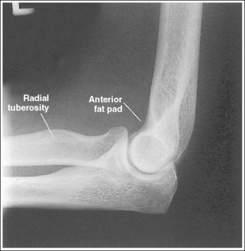 Radiographic Image Analysis