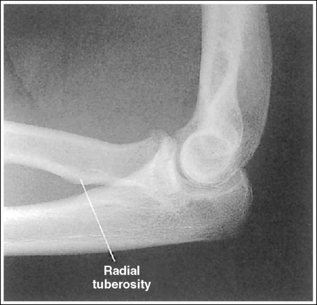 Radiographic Image Analysis