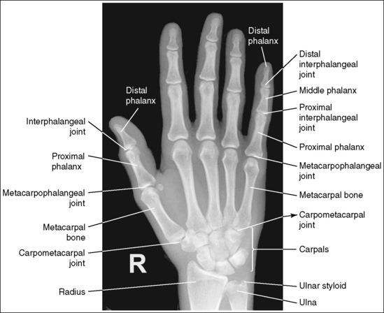 Radiographic Image Analysis
