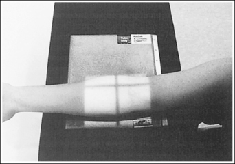 Radiographic Image Analysis