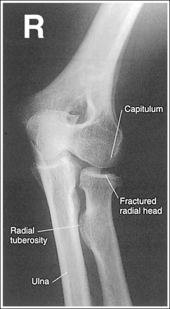 Radiographic Image Analysis