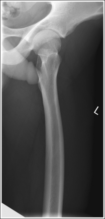 Radiographic Image Analysis