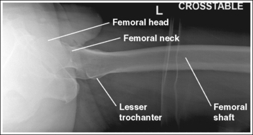 Radiographic Image Analysis